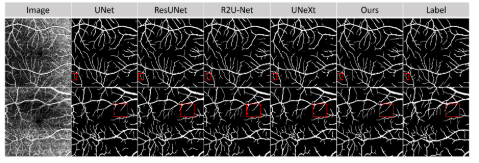 DB-UNet: MLP Based Dual Branch UNet for Accurate Vessel Segmentation in ...