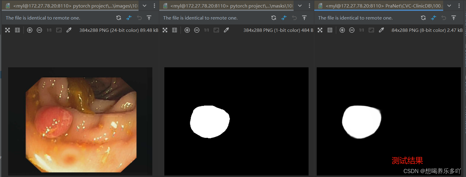 PraNet代码复现_pranet 代码复现-CSDN博客
