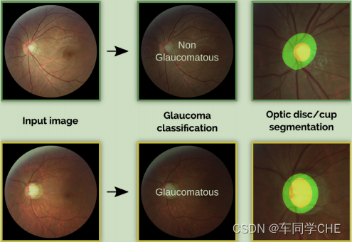 论文代码复现之Medical SAM Adapter (Junde Wu version)_raise runtimeerror(f ...