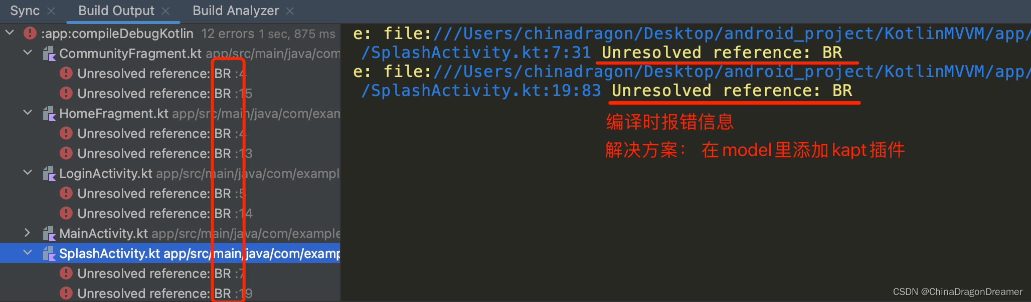 Android：使用Kotlin搭建MVVM架构模式_kotlin mvvm-CSDN博客