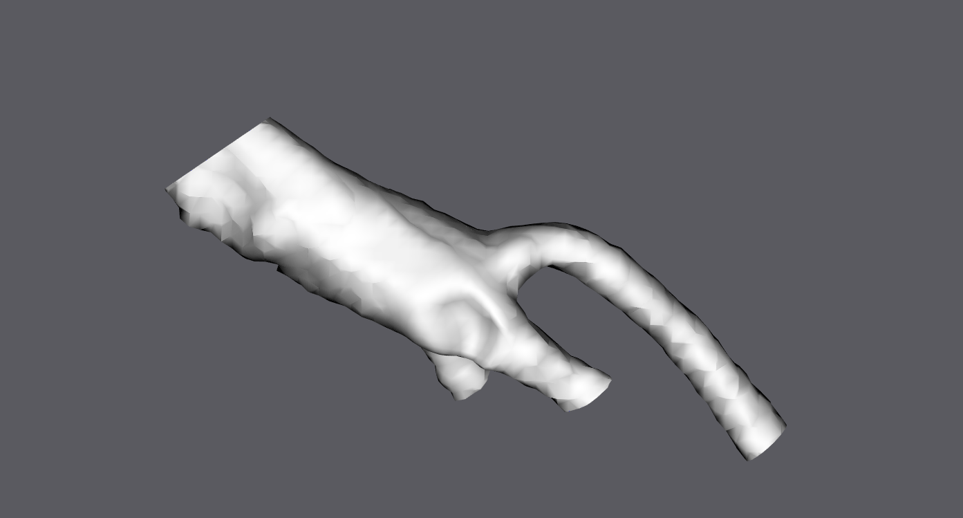 利用vtkwidget 实现剪裁_vtk使用包围盒vtkboxwidget交互式裁剪dicom图像-CSDN博客