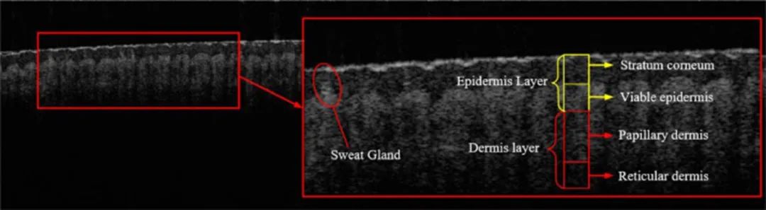 友思特应用 | 微观指尖世界：OCT成像应用之3D指纹提取与识别_光学干涉 指纹鉴定-CSDN博客