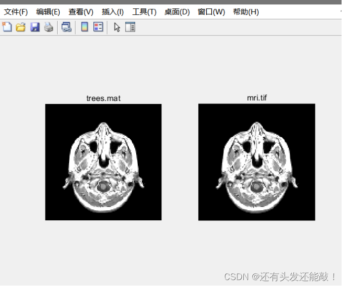 【数字图像】实验一matlab图像简单操作函数的应用matlab实验一实现图象基本操作图子图显示保存分通道显示等 Csdn博客