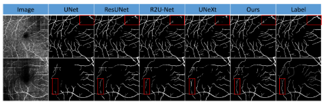 DB-UNet: MLP Based Dual Branch UNet for Accurate Vessel Segmentation in OCTA Images 论文总结_双分支unet ...