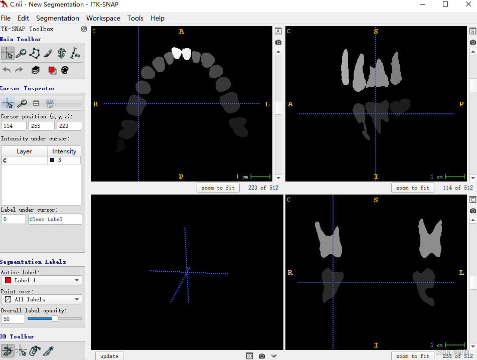 NII格式详解：神经影像学的多维数据格式-CSDN博客