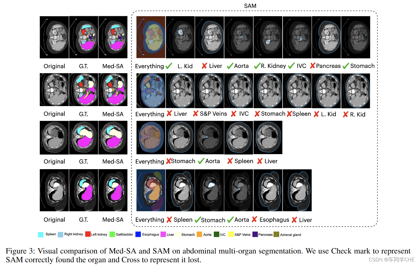 论文代码复现之Medical SAM Adapter (Junde Wu version)_raise runtimeerror(f ...