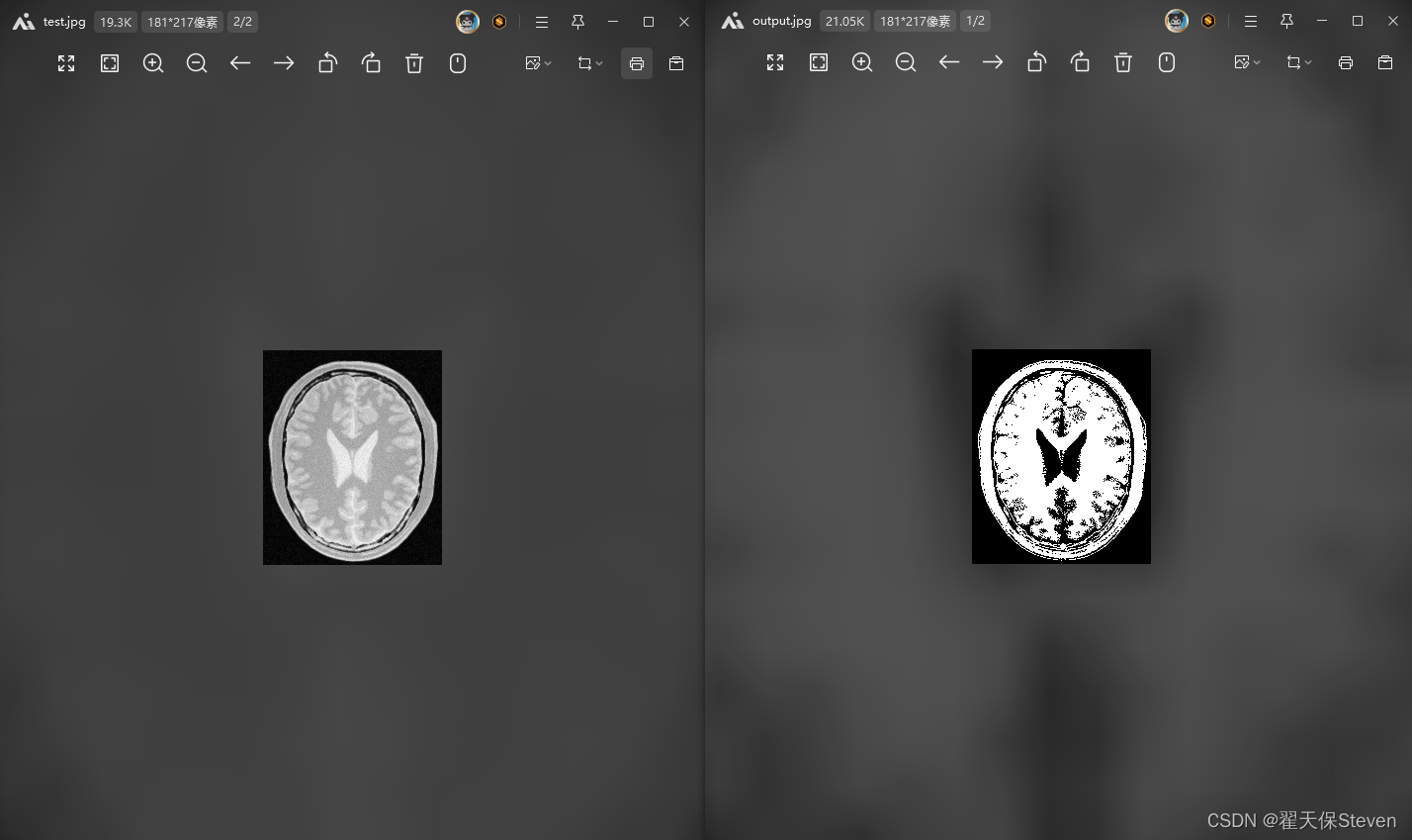 ITK-二值阈值分割（itkBinaryThresholdImageFilter）_itk::binarythresholdimagefilter-CSDN博客