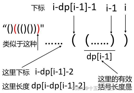 Leetcode第32题 最长有效括号leetcode 32 Csdn博客