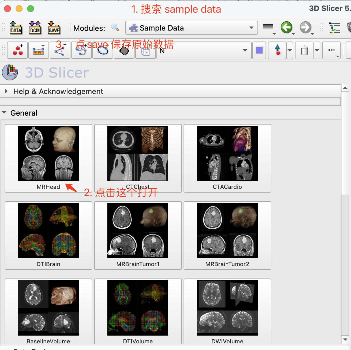 使用 Monai Bundle 和 Model Zoo 对医学影像数据进行分类-全脑133个结构分割-CSDN博客