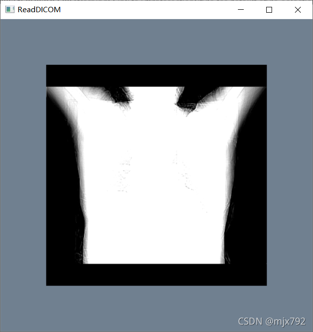 VTK(1)_读取DICOM图像_vtk读取dicom图像阈值直方图实现-CSDN博客