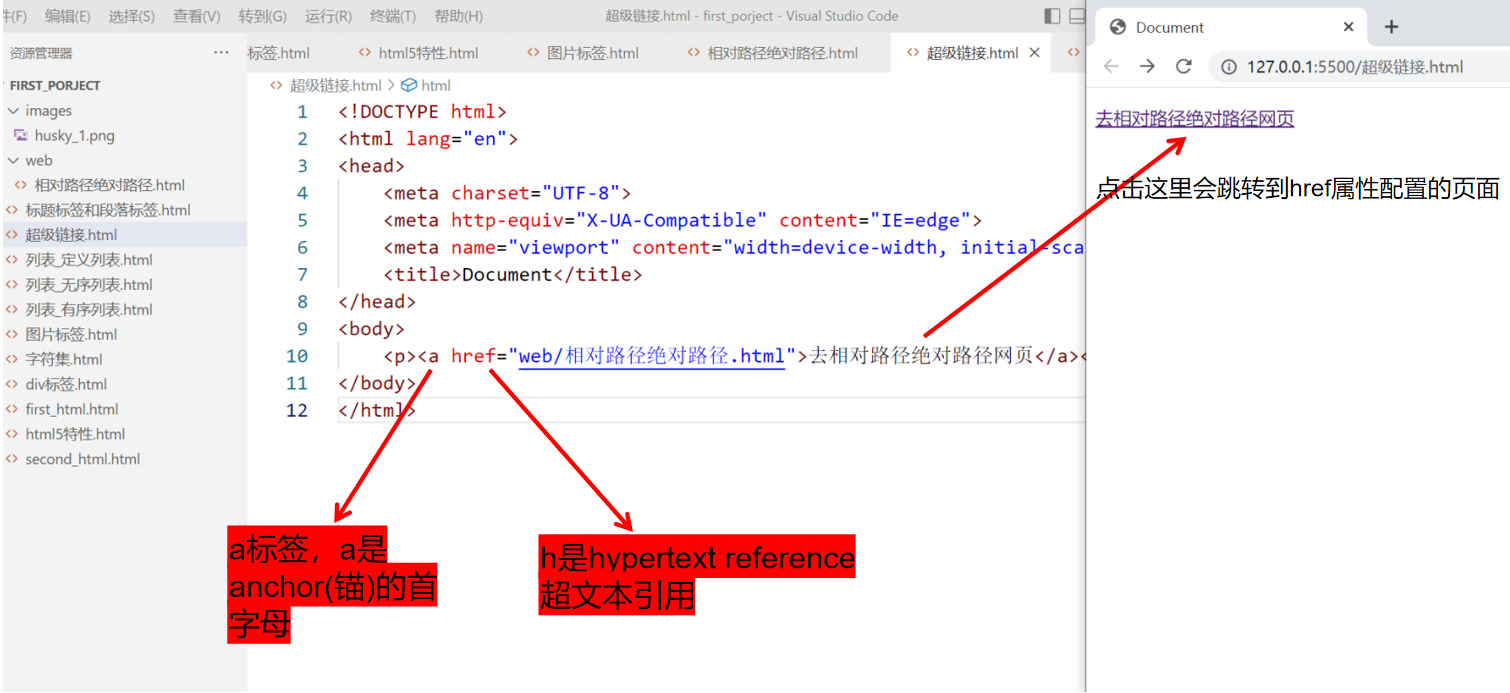 〖大前端 - 基础入门三大核心之 html 篇⑪〗- 超级链接_邮件超链接 网页代码-CSDN博客