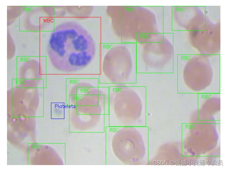 【YOLOv5】YOLOv5 物体检测血细胞计数和检测实现_yolov5训练bccd数据集-CSDN博客