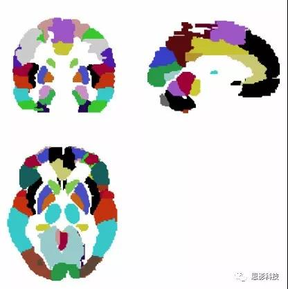 《大话脑成像》之：模板（mask）_aal模板怎么分网络-CSDN博客