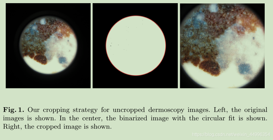Skin Lesion Classification Using Ensembles of Multi-Resolution EfficientNets with Meta Data ...