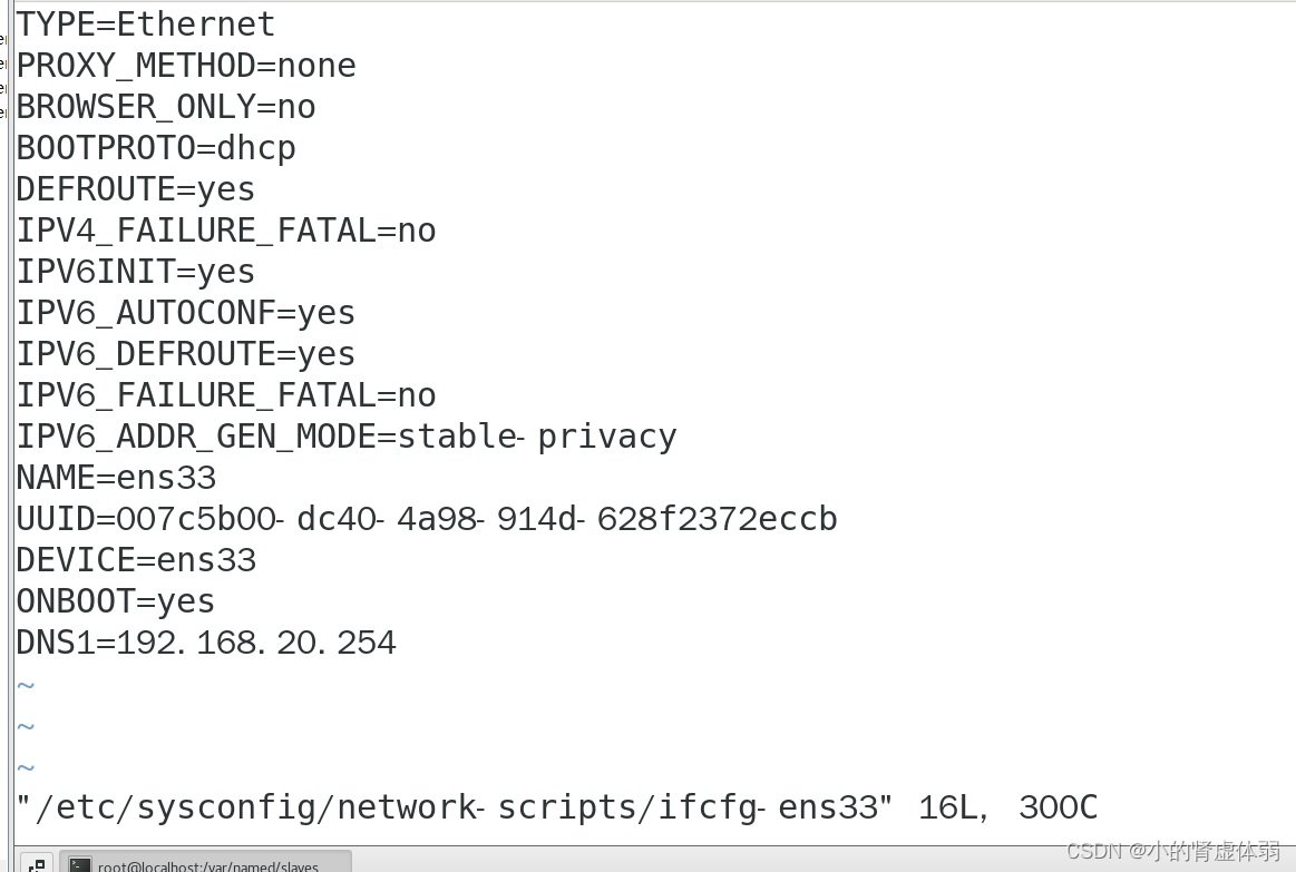 linuxDNS服务器配置_linux 修改dns-CSDN博客
