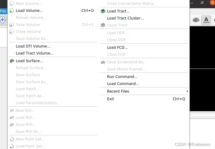 FreeSurfer入门(1) Output Data-CSDN博客