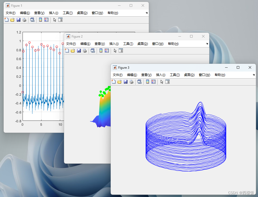 matlab使用PhysioNet的WFDB工具箱_physioshield工具箱-CSDN博客
