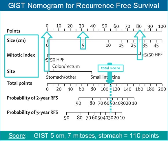 R语言列线图、诺模图(Nomogram)实战 ：以逻辑回归（logistics regression）为例介绍制作列线图（nomogram）的过程、绘制诺模图并解读诺模图-CSDN博客