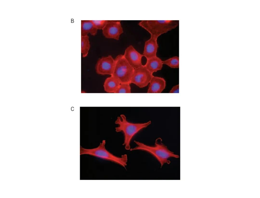 Wnt/β-catenin通路的激活途径在肿瘤研究的应用 - MedChemExpress_emt激活-CSDN博客