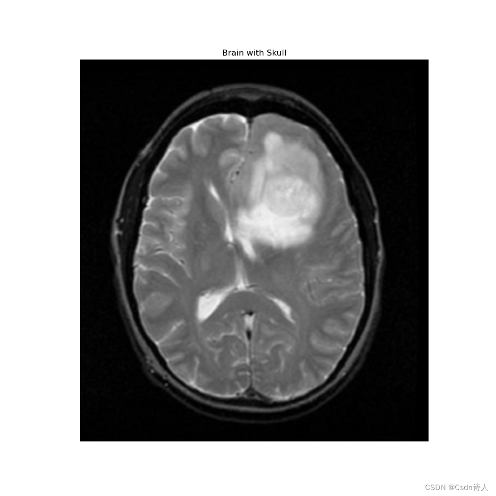 PythonOpenCV图像处理实践：灰度处理、二值化与形态学操作,-CSDN博客