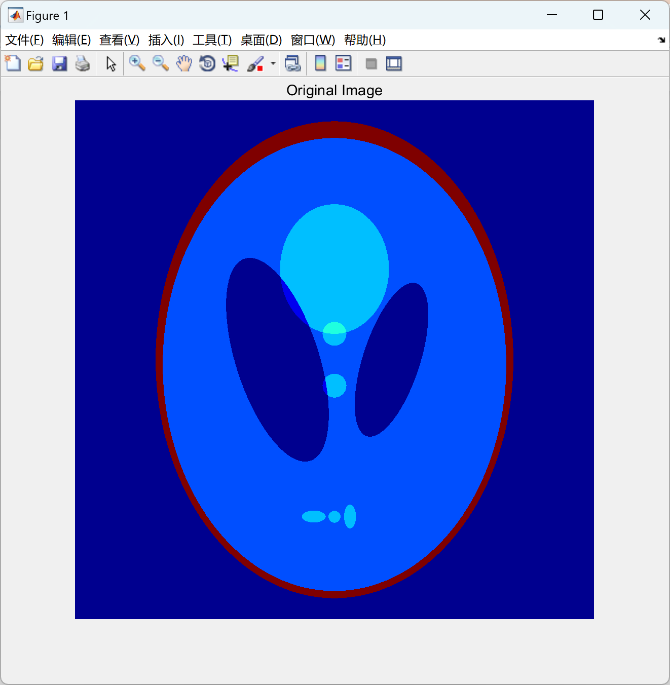 L1正则化问题的分裂Bregman方法（Matlab代码实现）_bregman迭代算法的正则化-CSDN博客