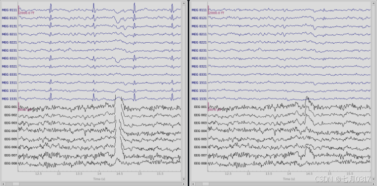 Python-MNE全套教程（官网翻译）-入门01：概述篇_mne-python-CSDN博客