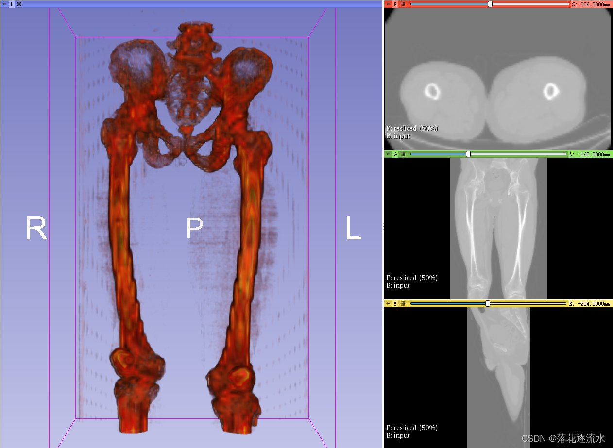 VTK学习笔记（三十九）vtkImageReslice-CSDN博客