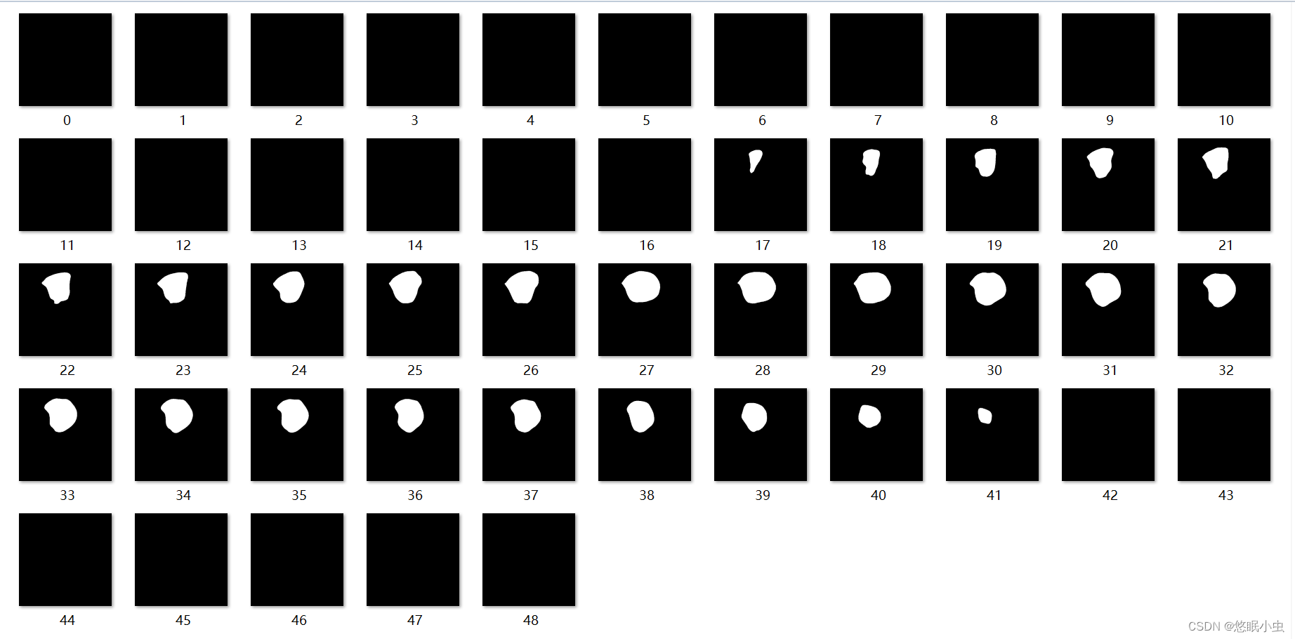 医学图像处理：nii格式转换(3D切片为2D)_.nii-CSDN博客
