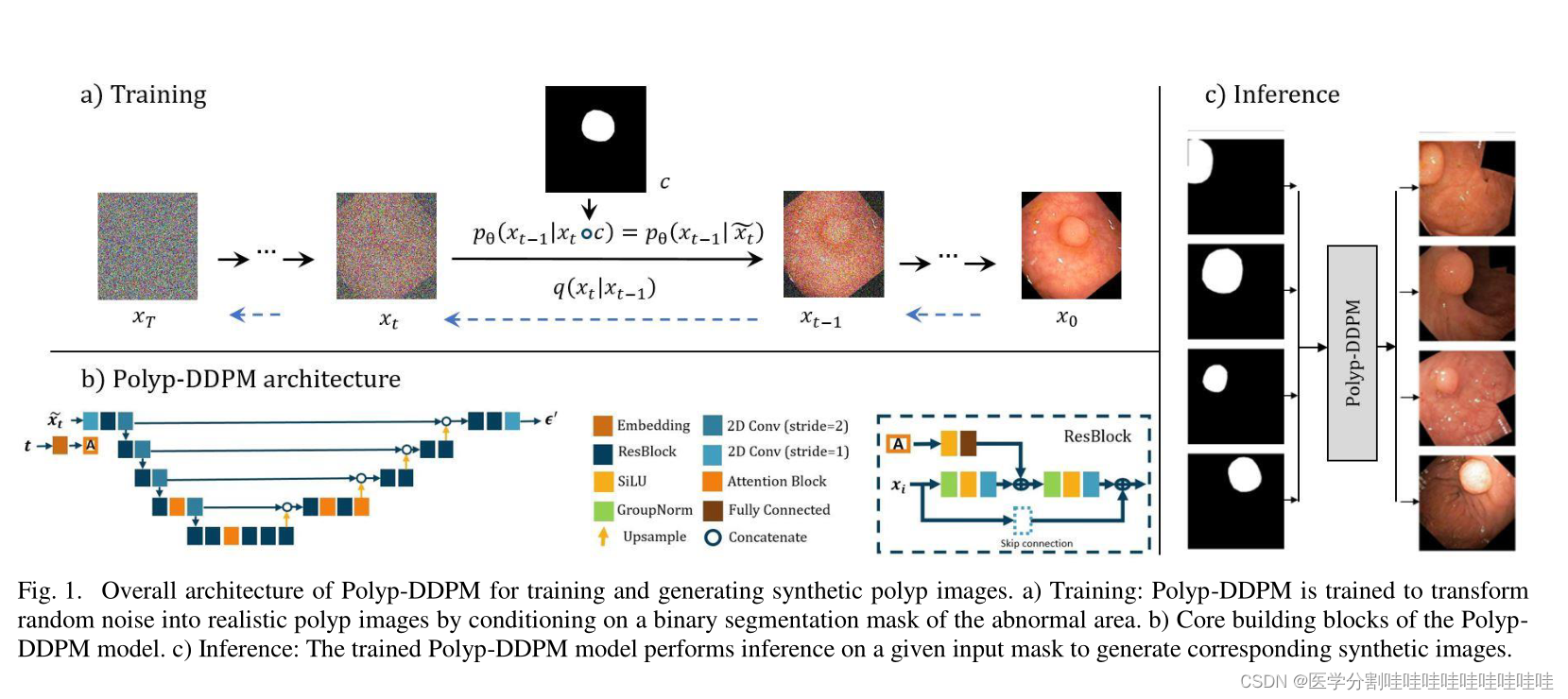 Polyp-DDPM: Diffusion-Based Semantic Polyp Synthesis for Enhanced Segmentation-CSDN博客