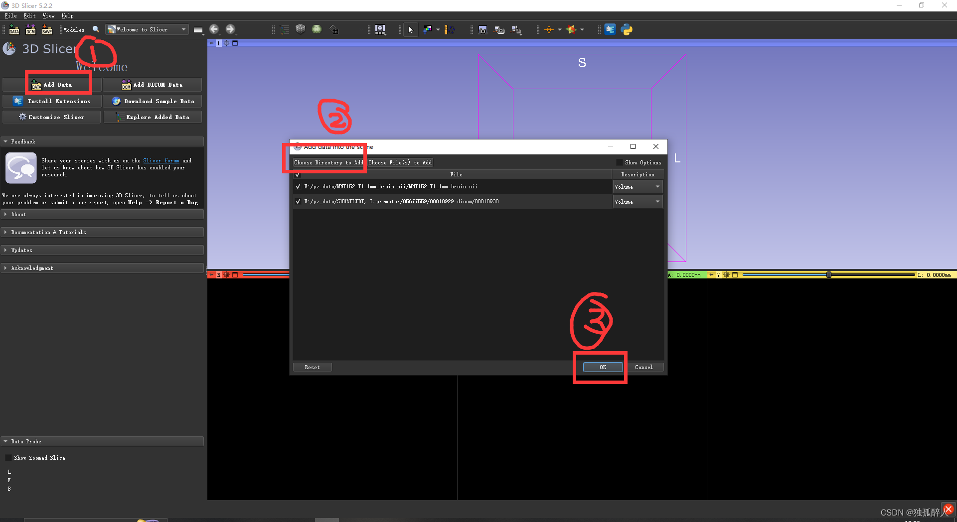 使用3D Slicer进行图像配准_使用3dslicer配准lpba40-CSDN博客