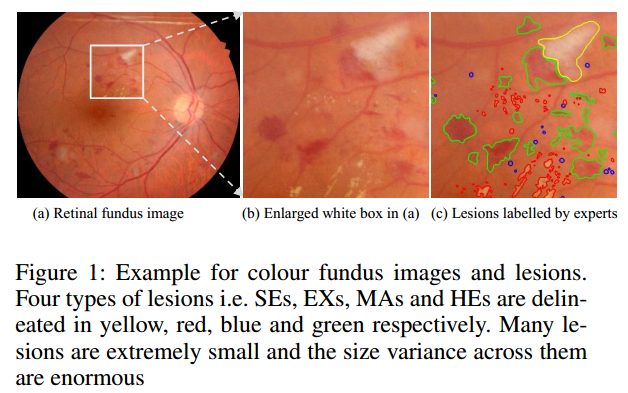 【文献阅读笔记】M2MRF: Many-to-Many Reassembly of Features for Tiny Lesion Segmentation in Fundus Images ...