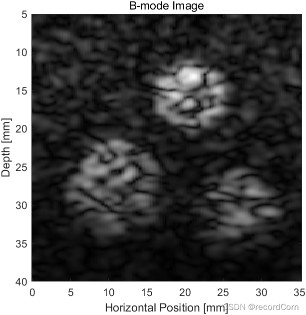 B模式超声成像仿真(MATLAB k-Wave仿真)_matlab实现超声b扫描-CSDN博客