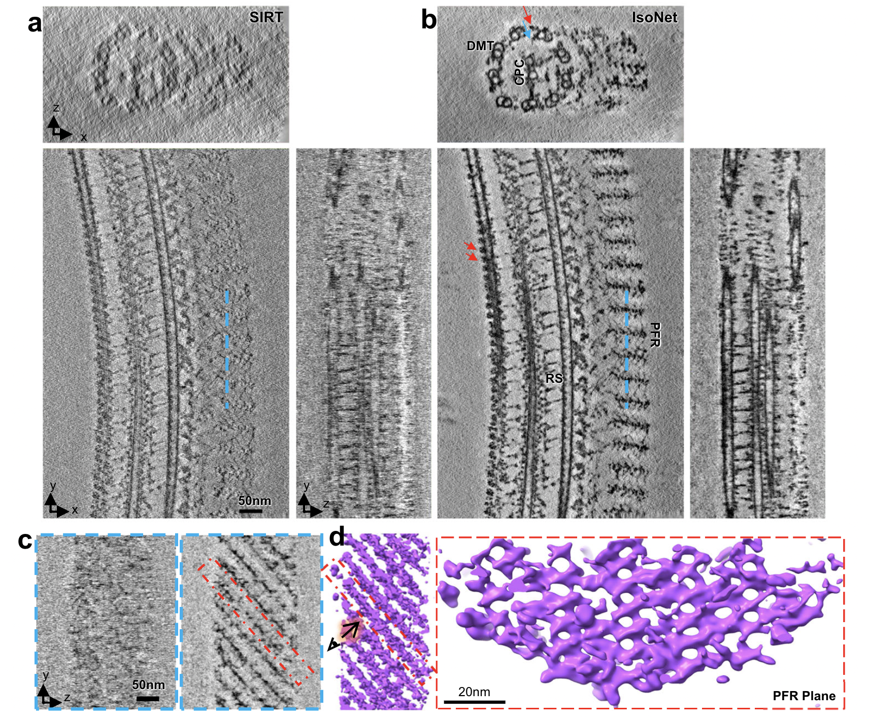 【论文阅读|cryoET】Isotropic reconstruction for electrontomography with deep ...