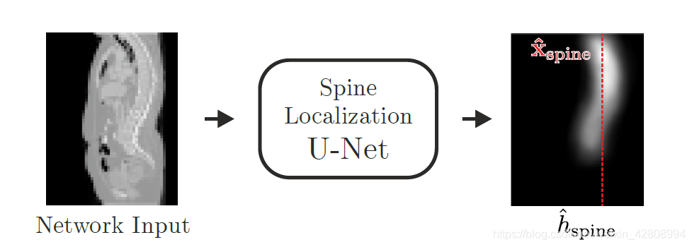 Coarse to Fine Vertebrae Localization and Segmentation论文笔记_spatialconfiguration-net-CSDN博客