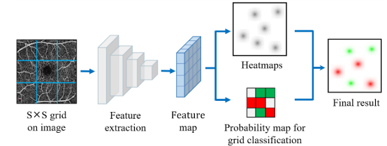 Retinal Structure Detection in OCTA Image via Voting-Based Multitask Learning论文总结-CSDN博客