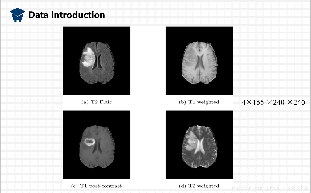 3D MRI brain tumor segmentation using autoencoder regularization-CSDN博客