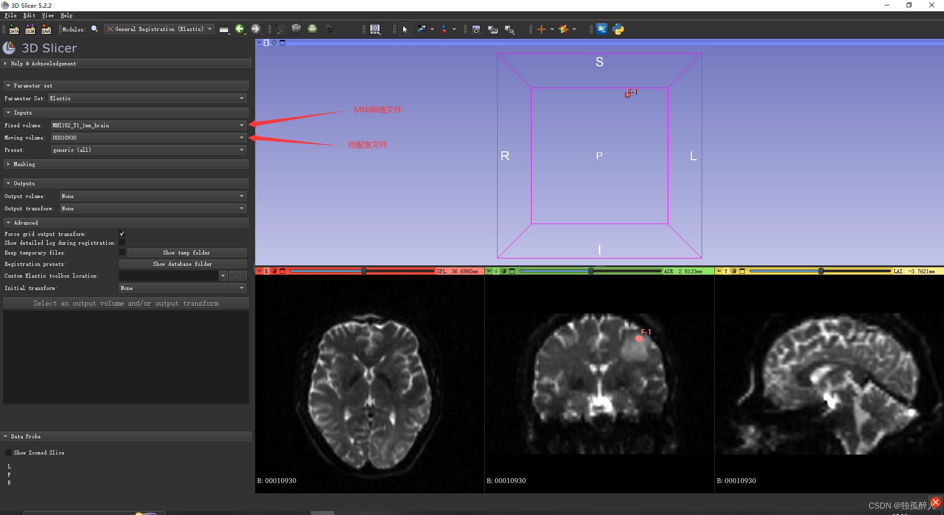 使用3D Slicer进行图像配准_使用3dslicer配准lpba40-CSDN博客