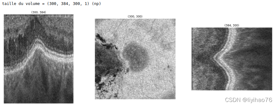 [python] 3D医学数据增强 示例+代码_传统数据增强代码3d-CSDN博客