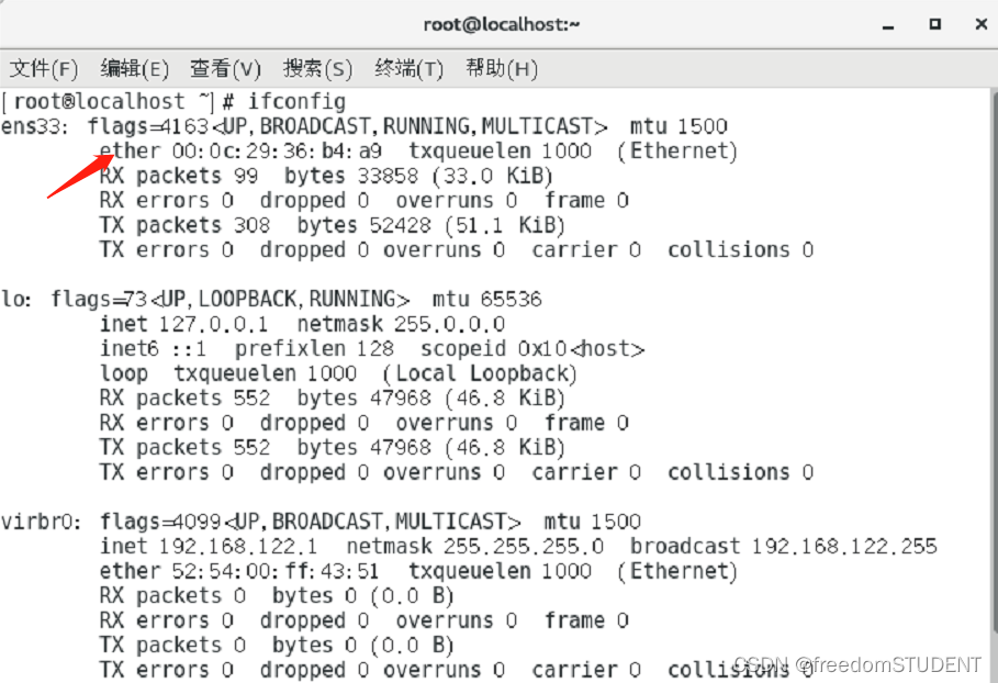 【Linux】Job for network.service failed(网卡启动报错）_linux重启网卡失败 failed-CSDN博客