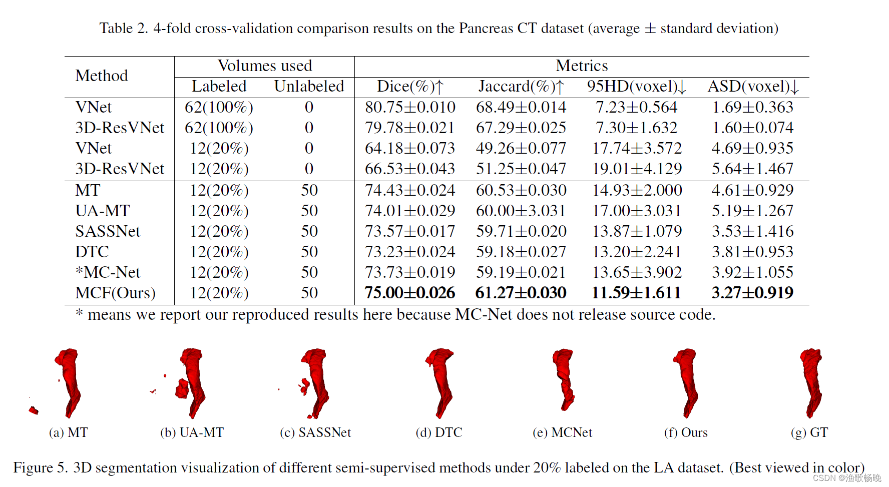 论文解读《Mutual Correction Framework for Semi-Supervised Medical Image Segmentation》_mcf: mutual ...