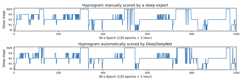 信号处理--使用CNN+LSTM实现单通道脑电信号EEG的睡眠分期评估_cnn+lstm处理eeg-CSDN博客