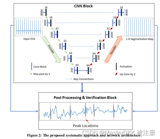 [论文评析]Robust R-Peak Detection in Low-Quality Holter ECGs using 1D Convolutional Neural Network ...