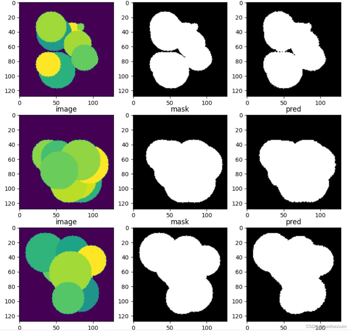 基于Kaggle学习MONAI（三）2D-Segmentation例程代码详解1_monai asdiscrete-CSDN博客