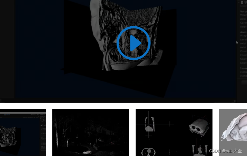 ActiViz 9.3.0 for .NET Crack_vtk:activiz9.3-CSDN博客