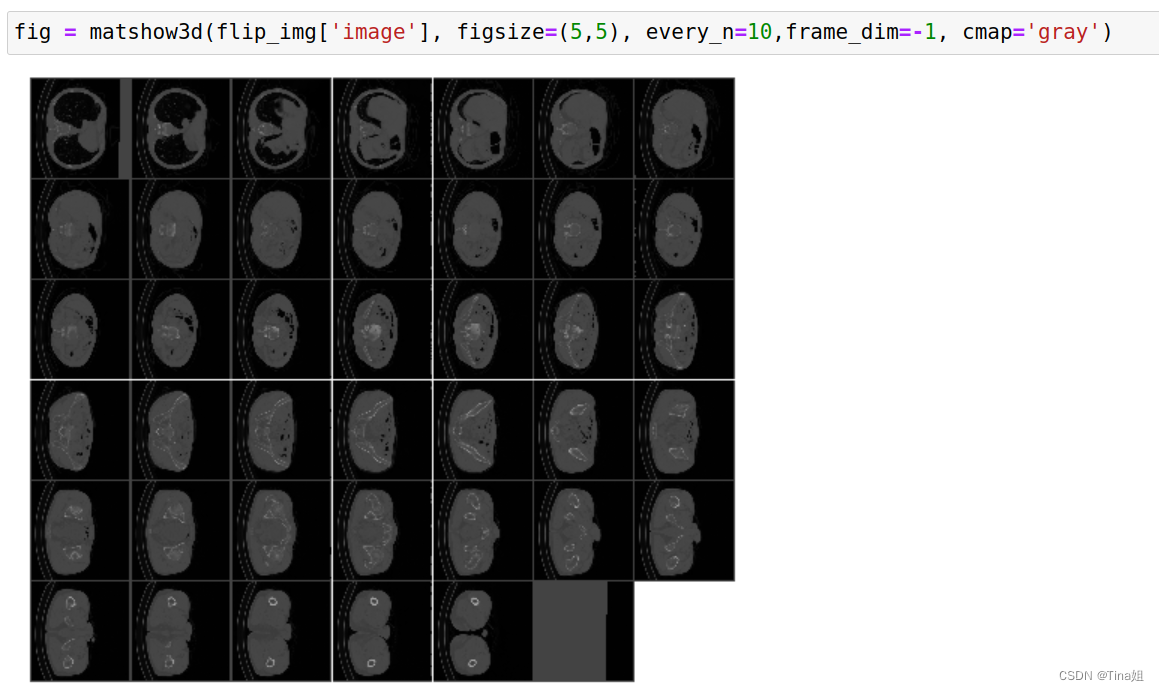 函数解析--monai.transforms.RandAxisFlipd-CSDN博客