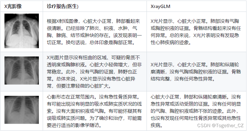 《XrayGLM：基于VisualGLM-6B微调训练对X光胸片进行医学诊断》学习分享与本地项目微调部署实践-CSDN博客