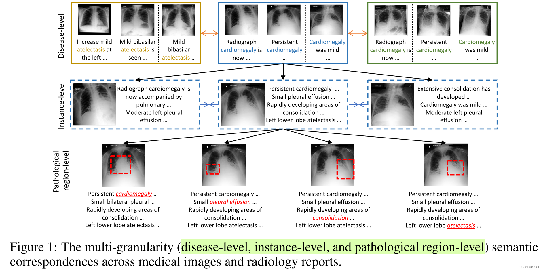 Multi-Granularity Cross-modal Alignment for Generalized Medical Visual Representation Learning ...