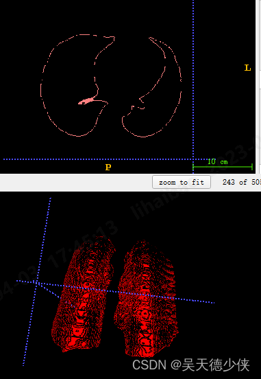 python+SimpleITK获取3D图像的轮廓_simpleitk 3d绘制-CSDN博客