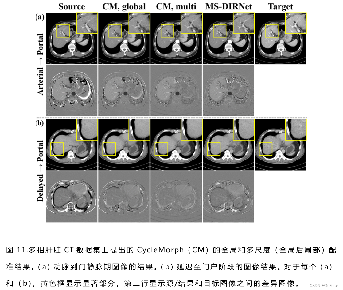 论文笔记：CycleMorph: Cycle Consistent UnsupervisedDeformable Image Registration-CSDN博客