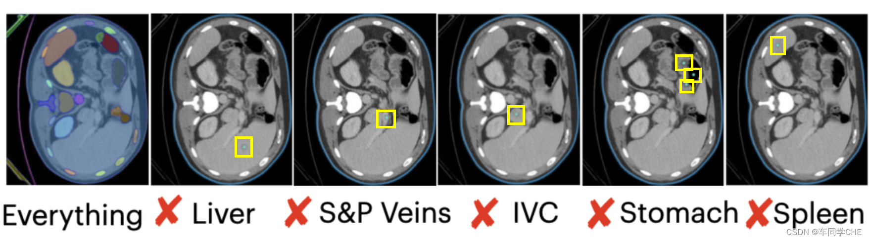 论文代码复现之Medical SAM Adapter (Junde Wu version)_raise runtimeerror(f ...